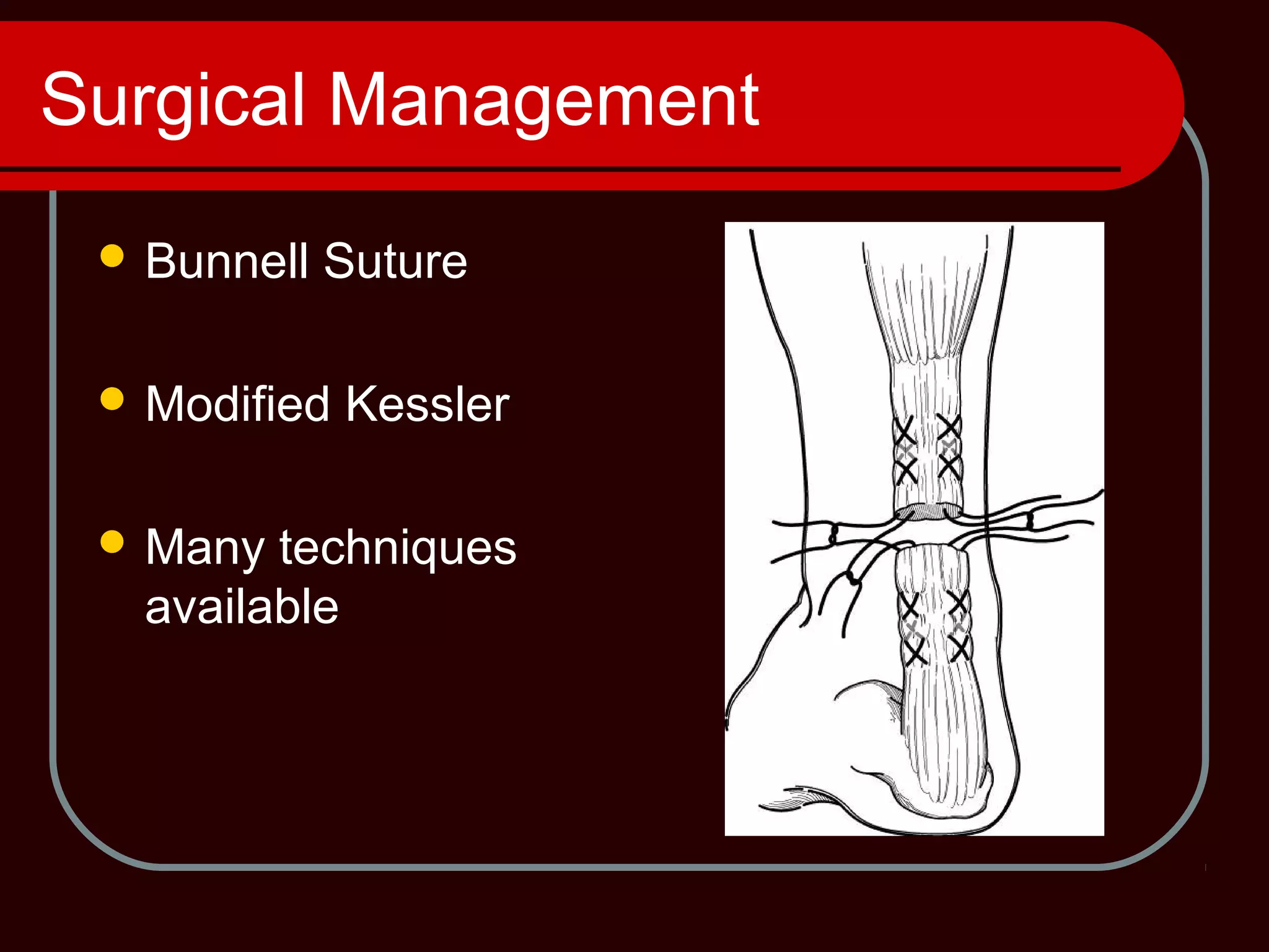 Achilles tendon pathology | PPT