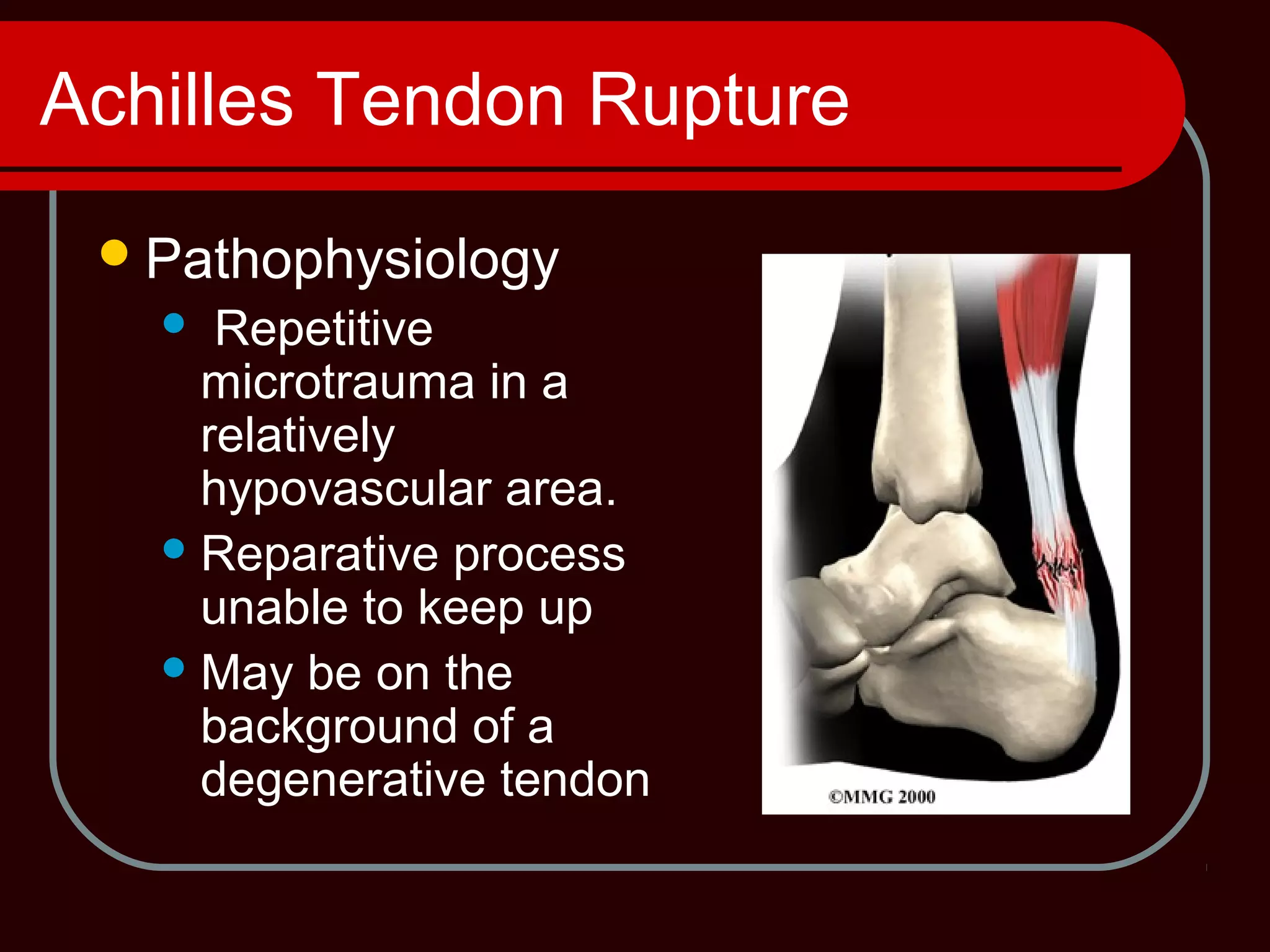 Achilles tendon pathology | PPT