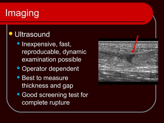 Achilles tendon pathology | PPT
