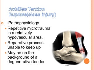 Achilles tendon for presentation | PPTX