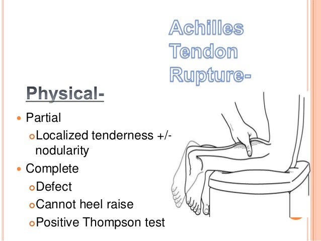 Achilles Tendon For Presentation