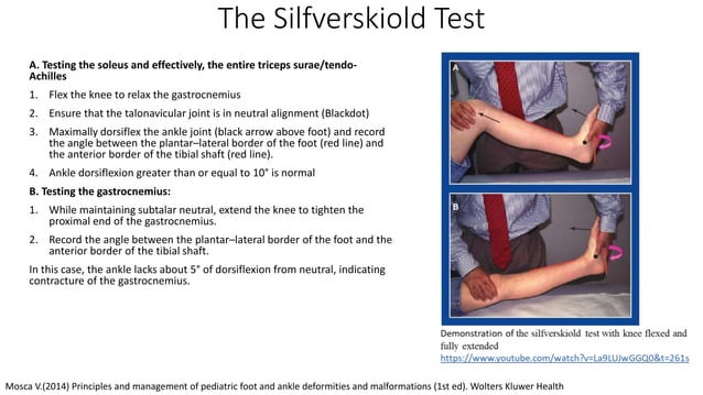 Achilles Tendon Lengthening.pptx
