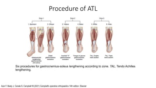 Achilles Tendon Lengthening.pptx