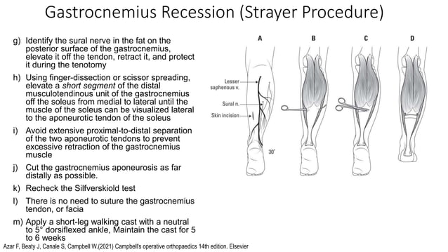 Achilles Tendon Lengthening.pptx
