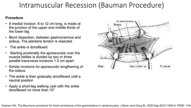 Achilles Tendon Lengthening.pptx