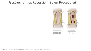 Achilles Tendon Lengthening.pptx