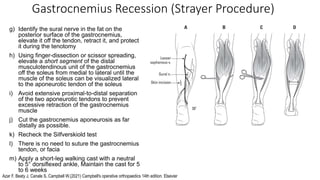 Achilles Tendon Lengthening.pptx