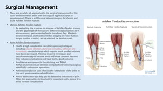Achilles Tendon Rehabilitaion- summary .pptx