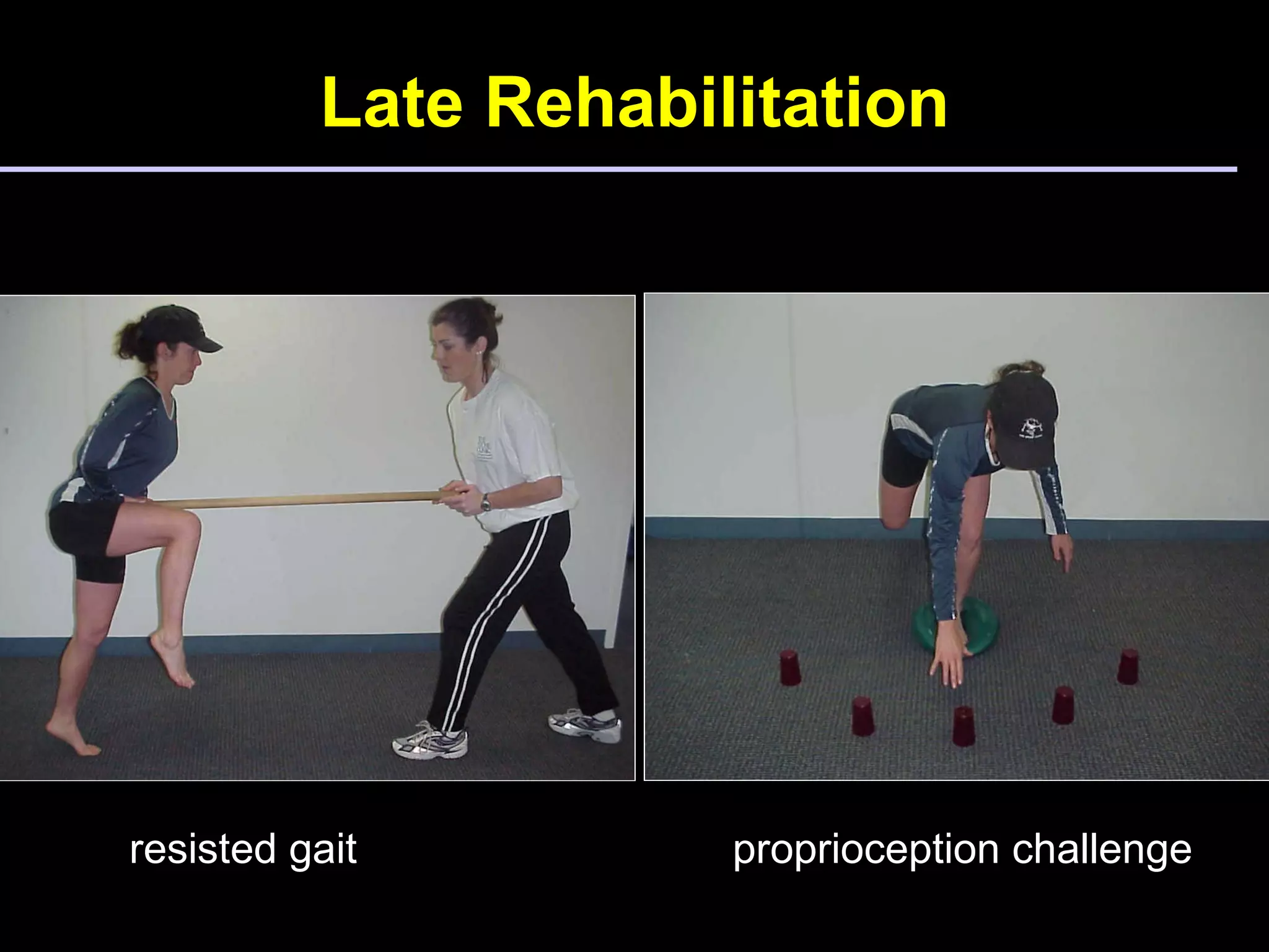 Achilles tendon repair | PPT