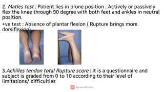 ACHILLES TENDON RUPTURE.pdf