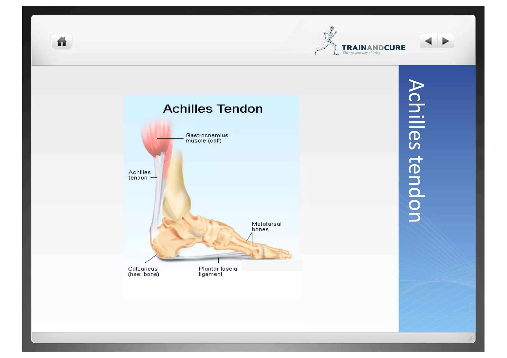 Achilles tendon rupture | PDF