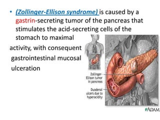 Achlorhydria and peptic ulcer | PPTX
