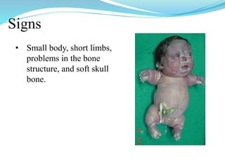 Achondrogenesis type 1a. pptx | PPTX