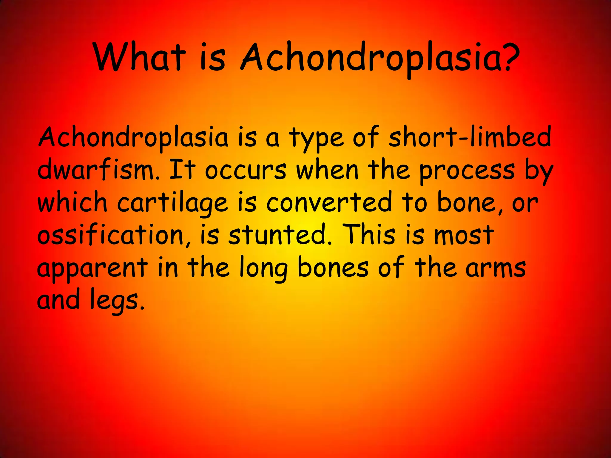 Achondroplasia | PPTX