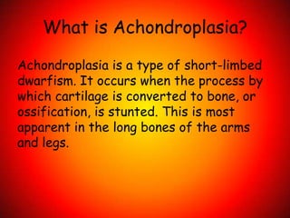 Achondroplasia | PPTX
