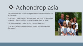 Achondroplasia | PPTX