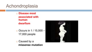 achondroplasia.pptx