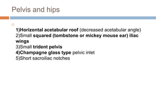 achondroplasia.pptx