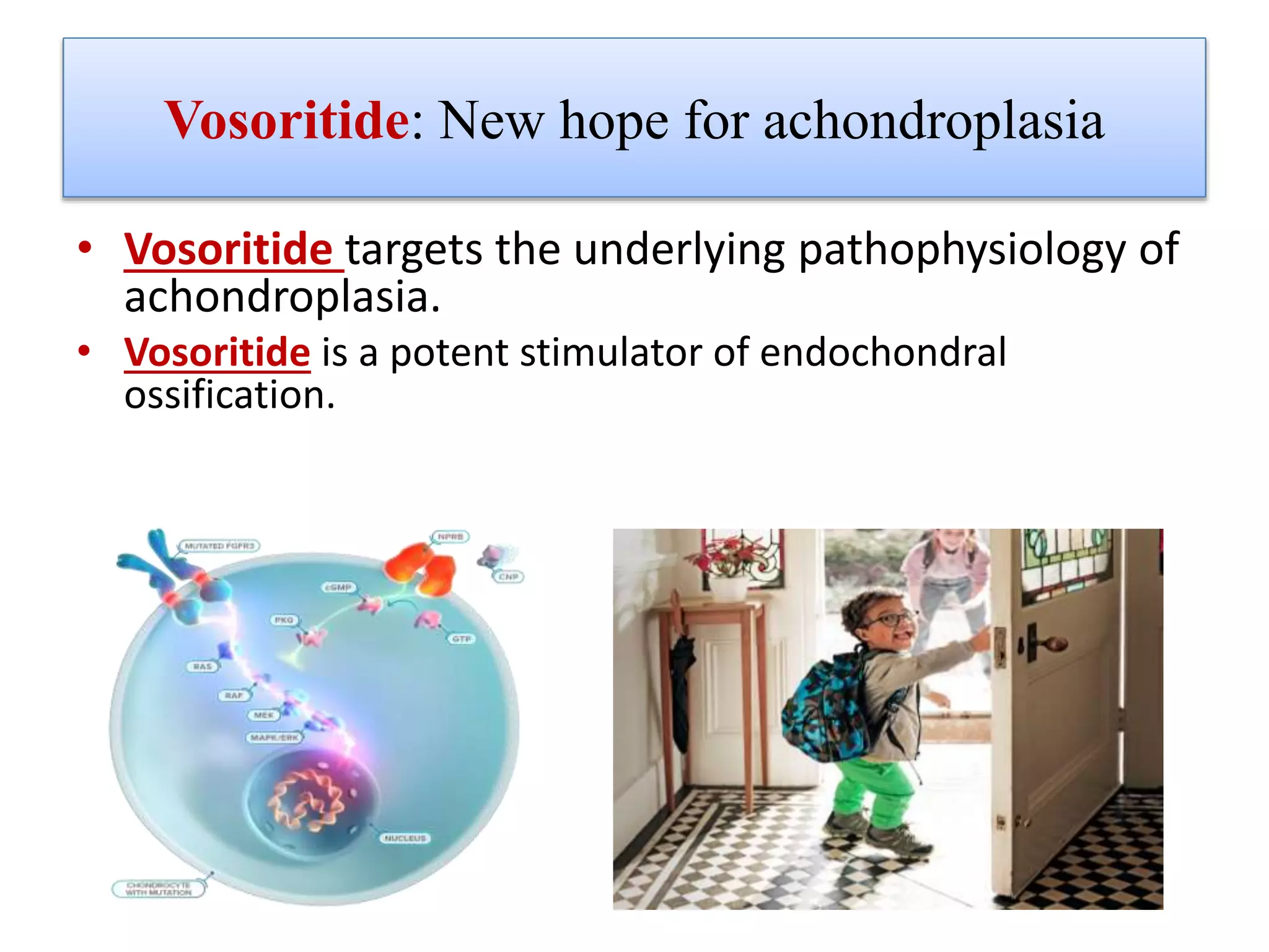 Achondroplasia in children.pptx