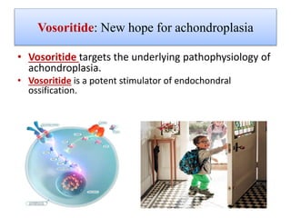 Achondroplasia in children.pptx