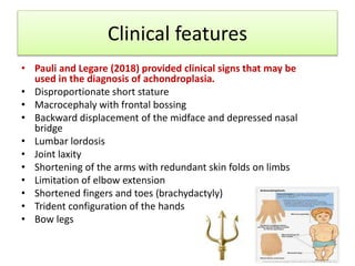 Achondroplasia in children.pptx