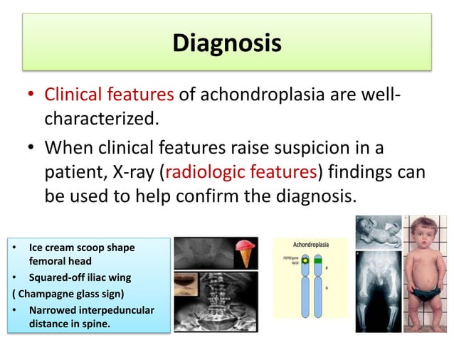 Achondroplasia in children.pptx | Bone and Joint Conditions | Diseases ...