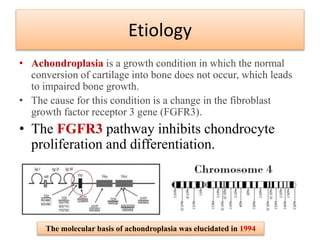 Fgfr3 Mutation Achondroplasia