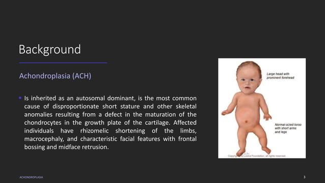 Achondroplasia | PPTX | Bone and Joint Conditions | Diseases and Conditions