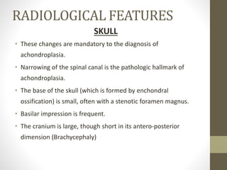 Achondroplasia, pseudochondroplasia & hypochondroplasia | PPTX