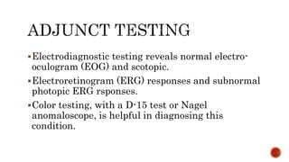 Achromatopsia Ocular signs & symtoms | PPT