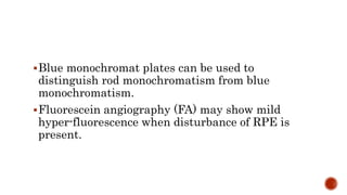 Achromatopsia Ocular signs & symtoms | PPT