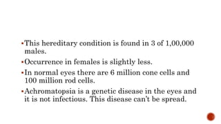 Achromatopsia Ocular signs & symtoms | PPT