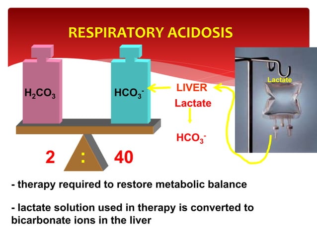 Acid base balance (2).ppt | PPT | Lung and Respiratory Health ...