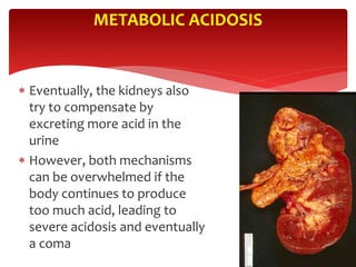 Acid base balance (2).ppt | PPT