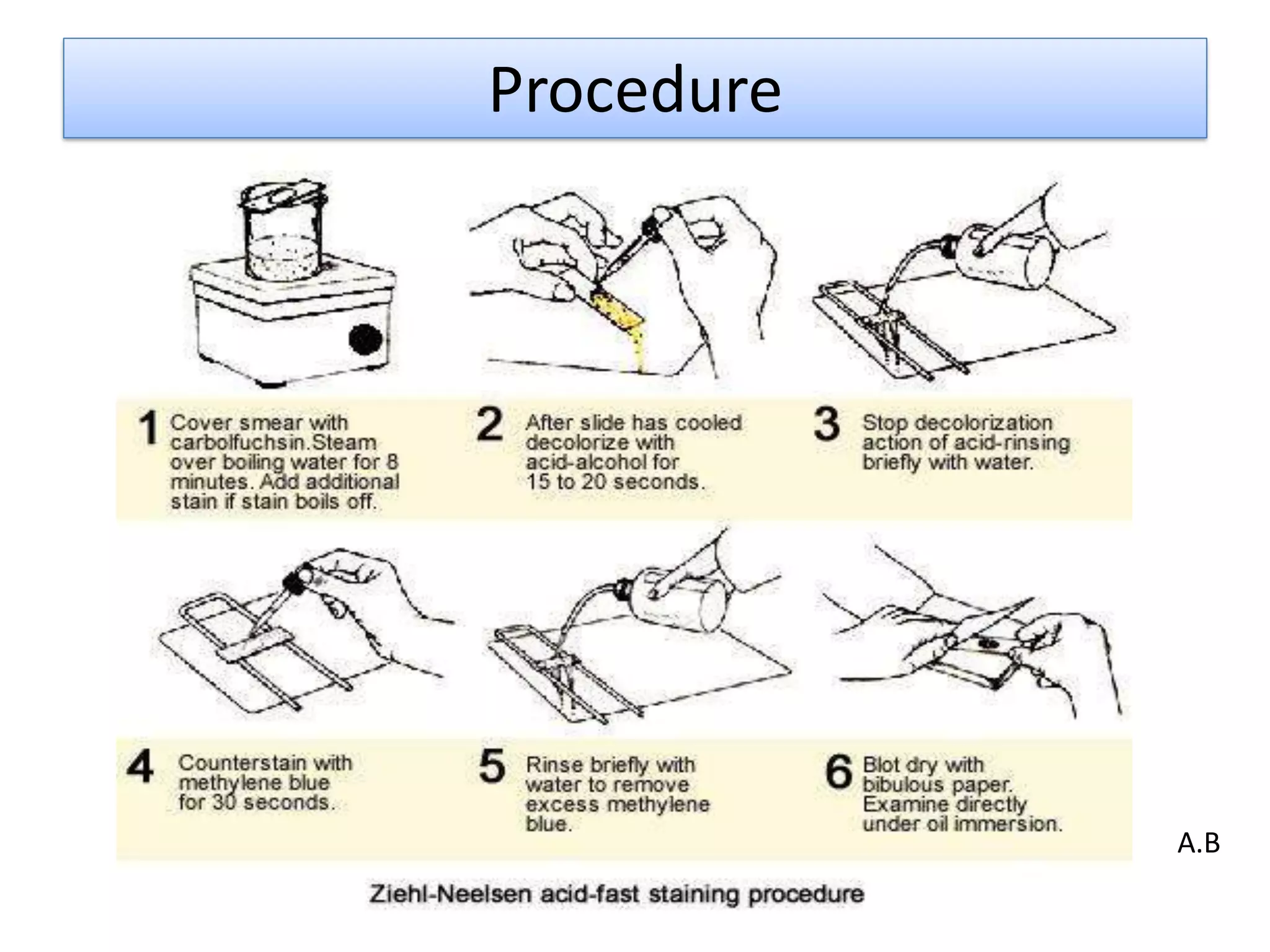 Acid fast staining | PDF