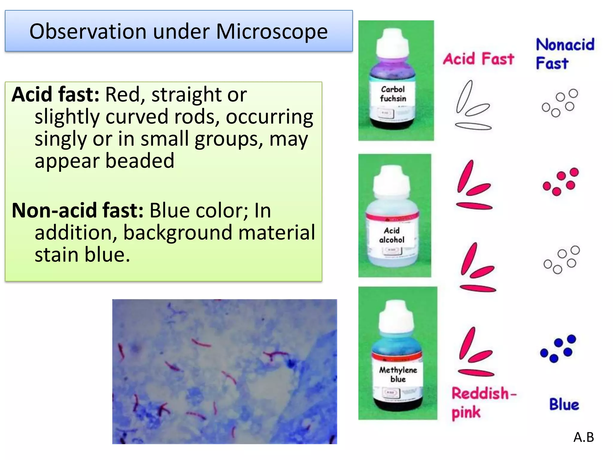 Acid fast staining | PDF