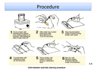 Acid fast staining | PDF