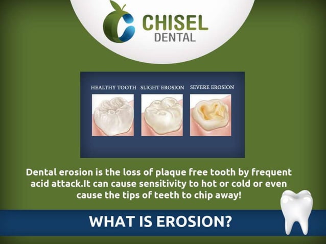 This is How Acid affects your Teeth | PPTX