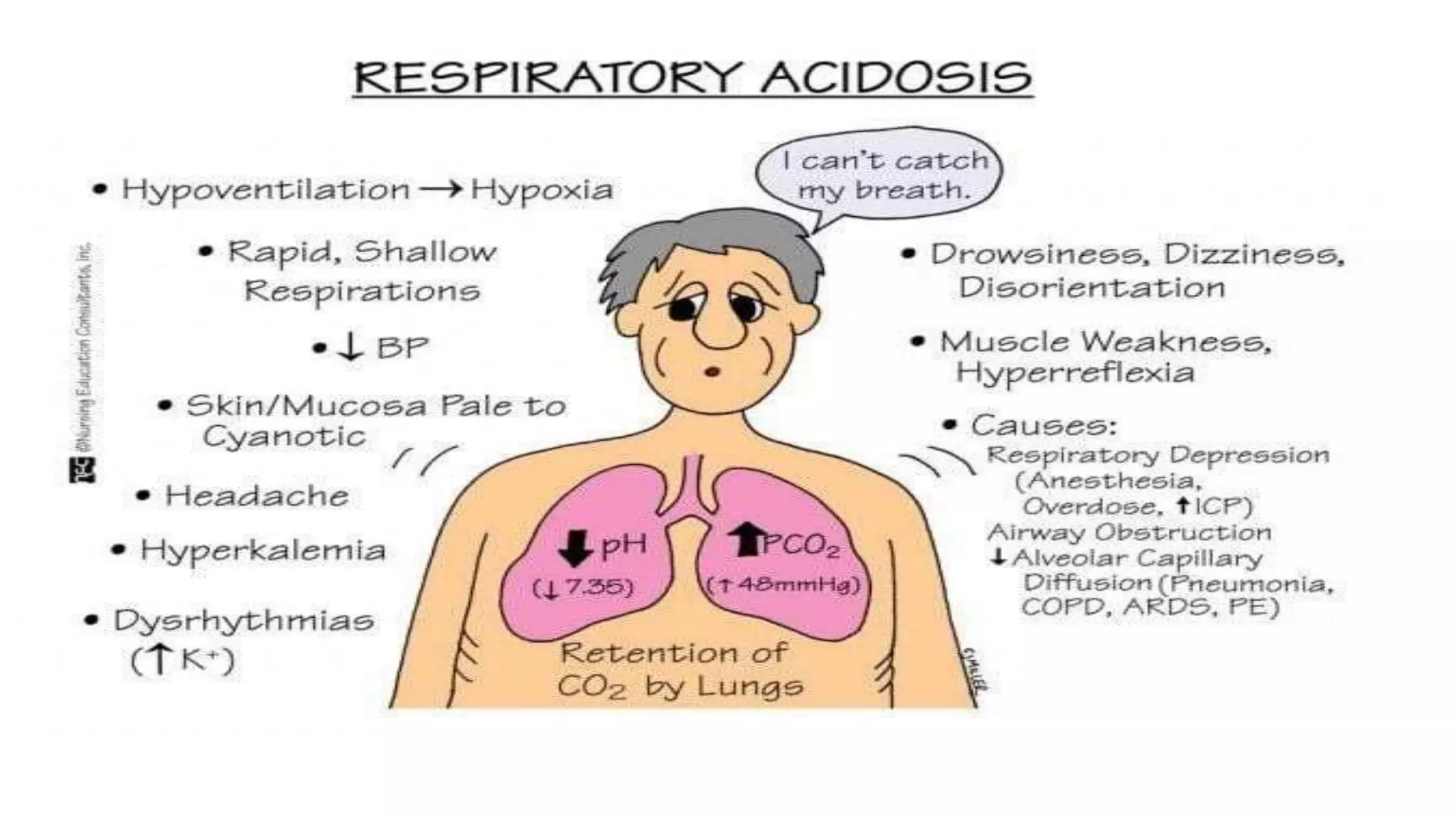 Acid base imbalance PPT for nurses. | PPTX