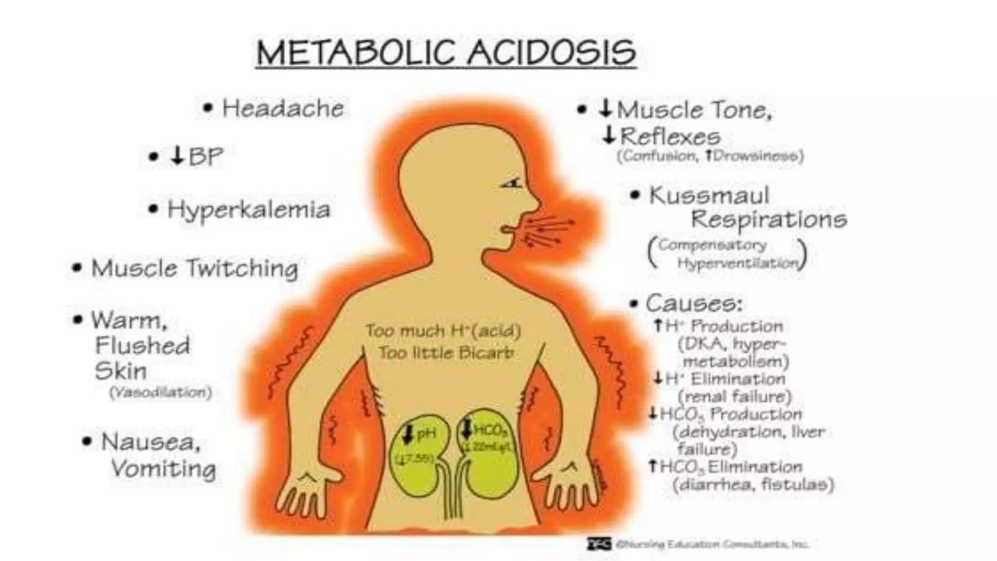 Acid base imbalance PPT for nurses. | PPTX