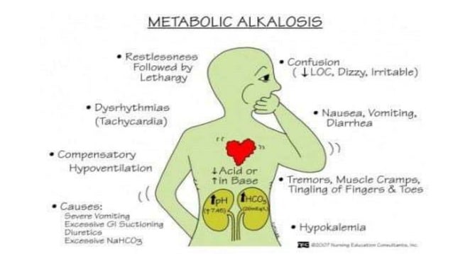 Acid base imbalance PPT for nurses. | PPTX | Lung and Respiratory ...