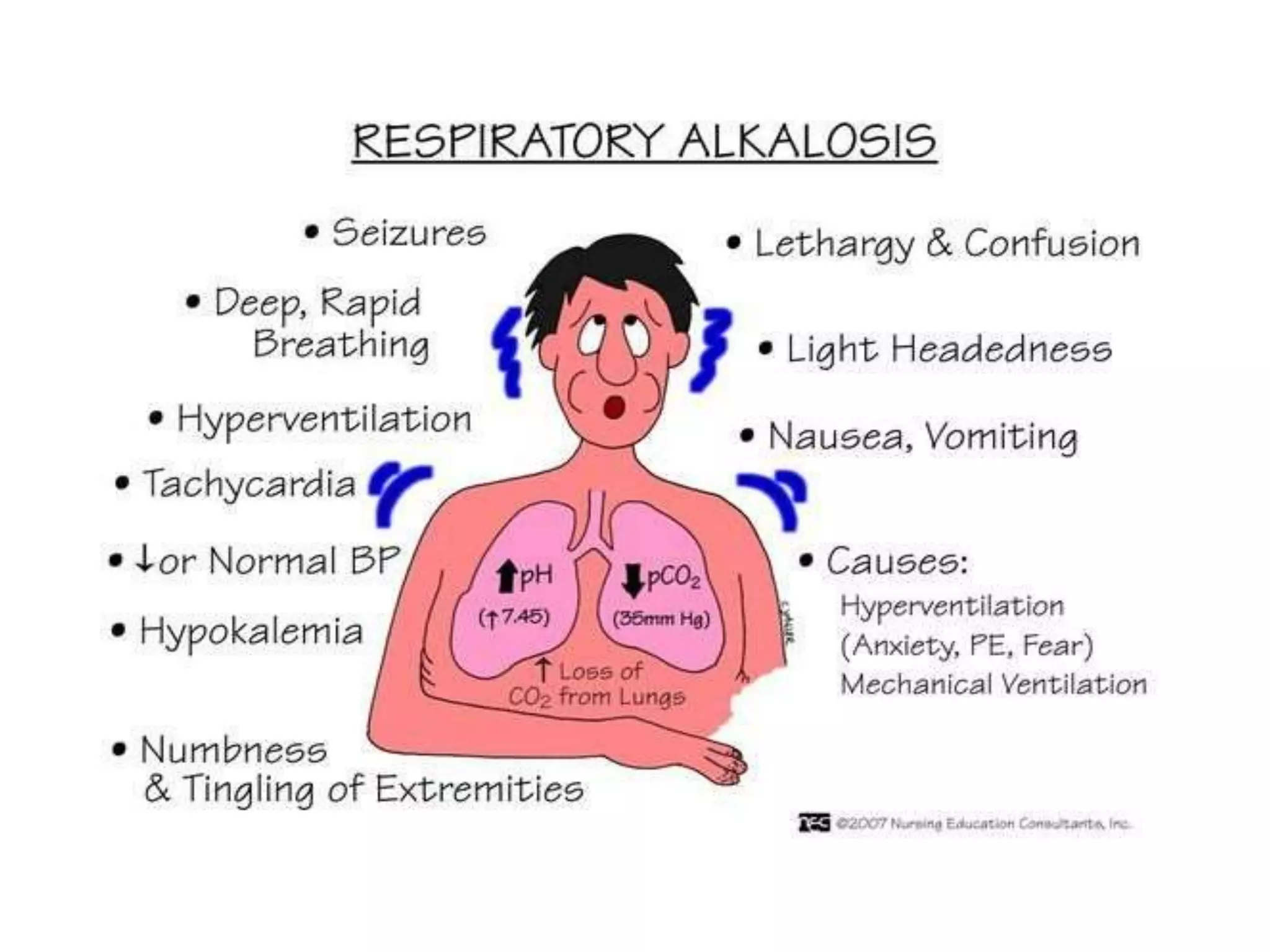 ACID BASE IMBALANCES ppt.pptx