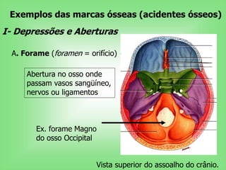 Acidentes Osseos.ppt