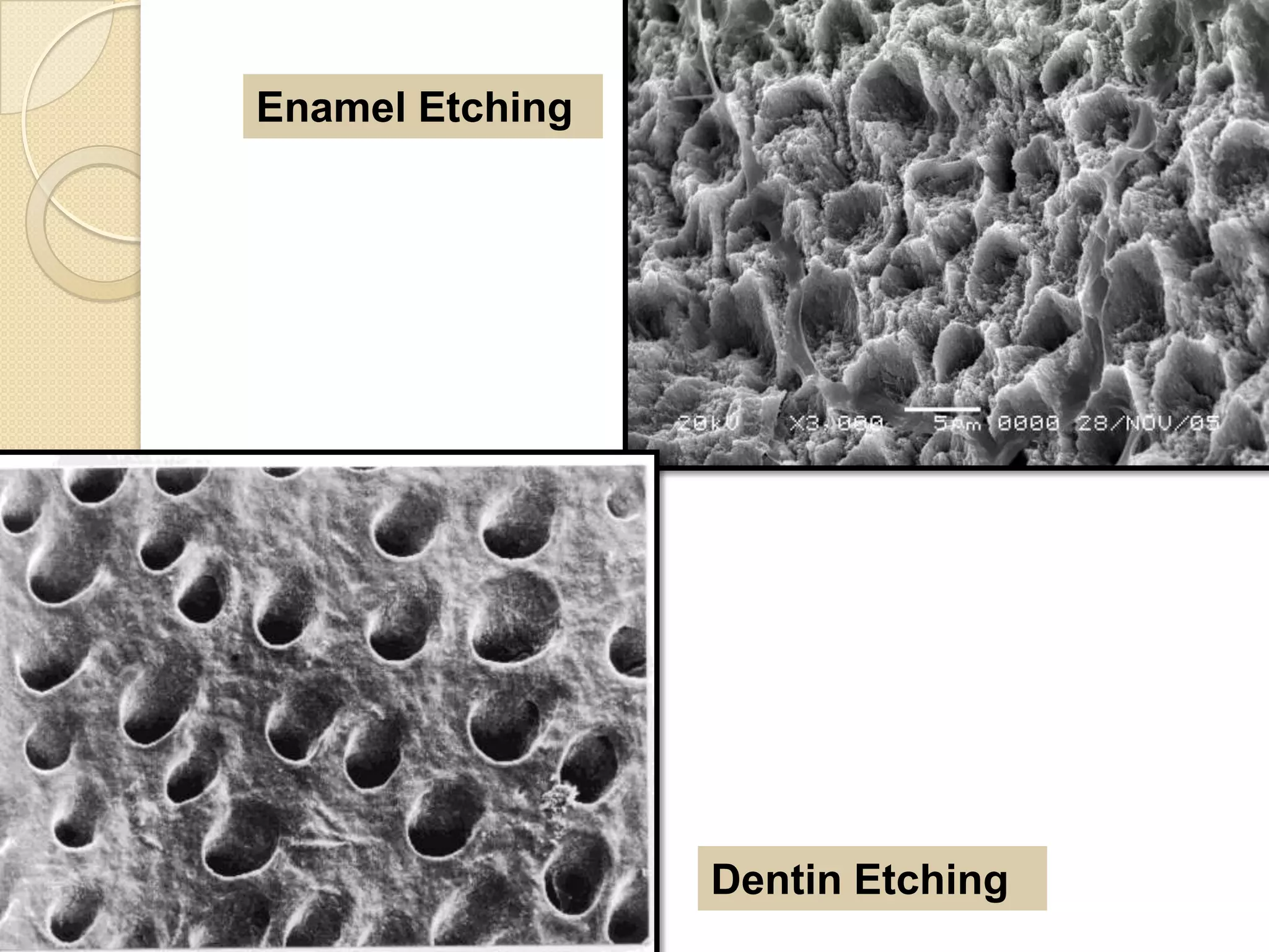 Acid Etching of Enamel and Bond Strength | PPTX