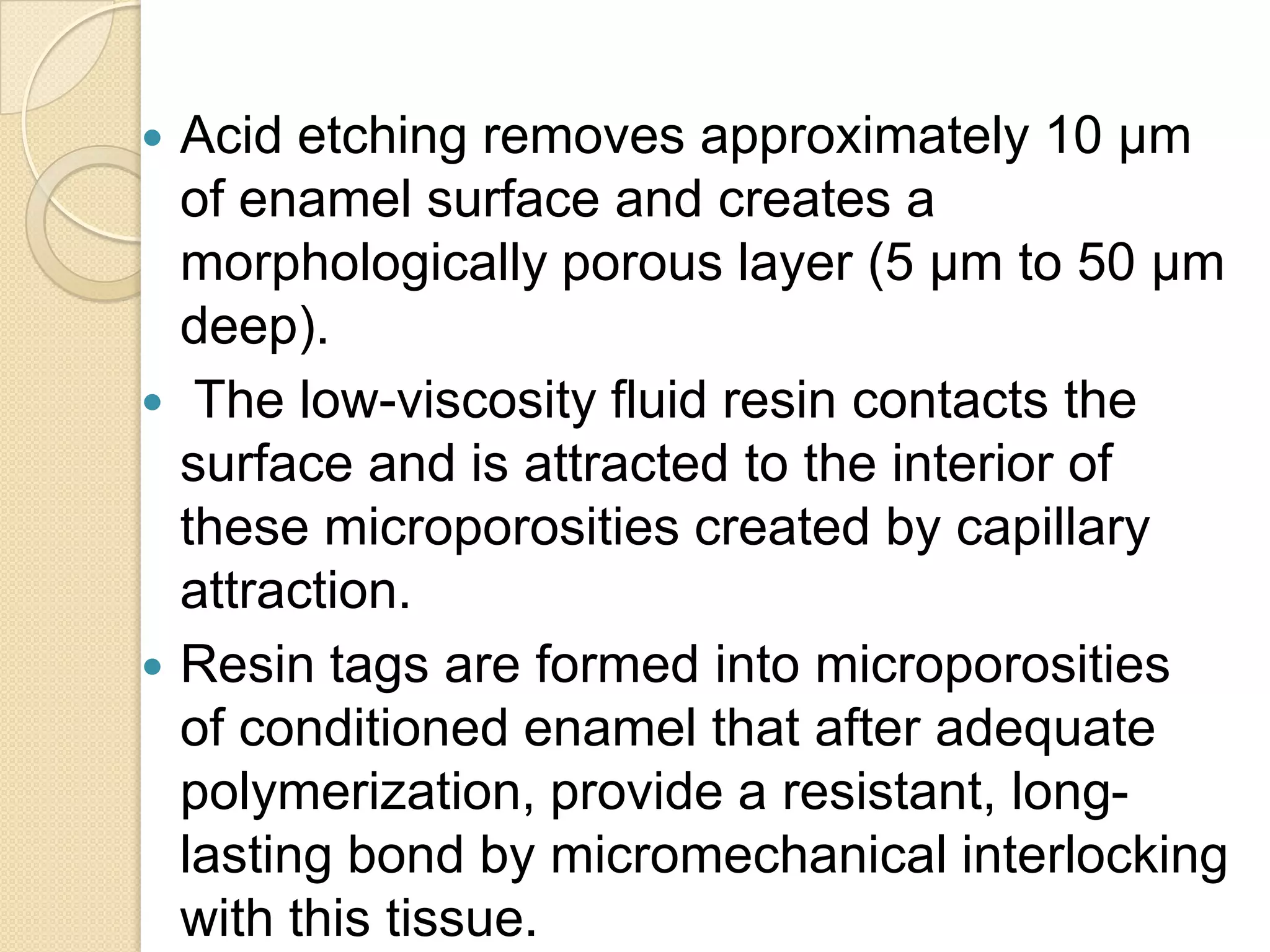 Acid Etching of Enamel and Bond Strength | PPTX