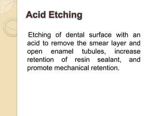 Acid Etching of Enamel and Bond Strength | PPTX