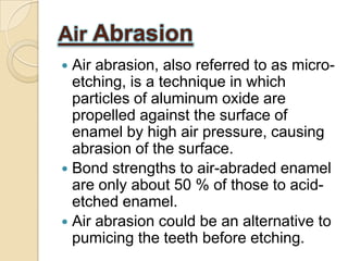 Acid Etching of Enamel and Bond Strength | PPTX
