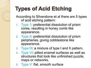 Acid Etching of Enamel and Bond Strength | PPTX