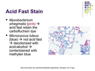 Acid fast stain - PRINCIPLE AND PROCEDURE | PPT