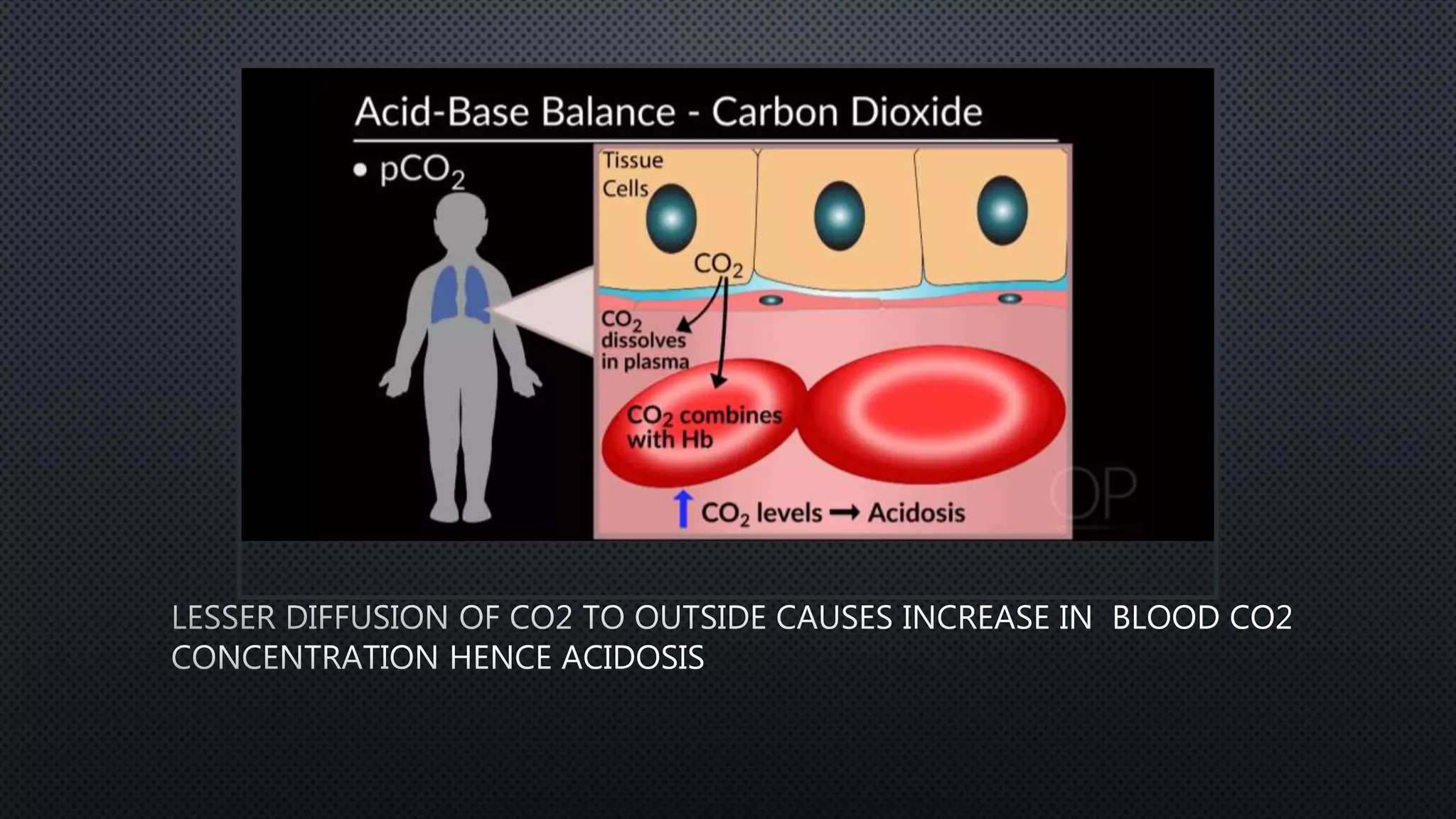 Acidosis and alkalosis real real plus | PPT